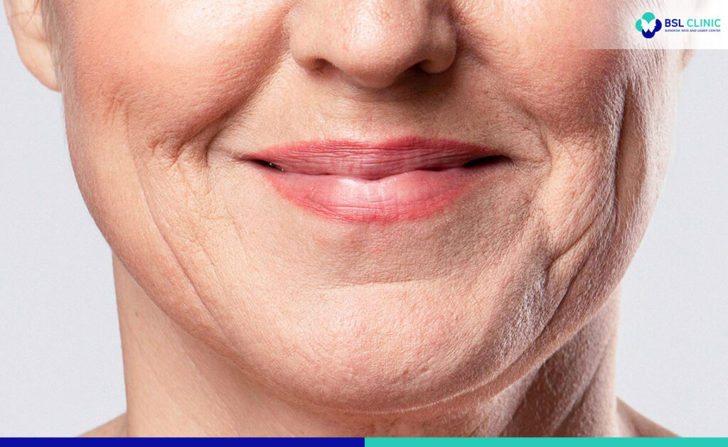 Face Wrinkle Reduction - Bangkok Aesthetic Clinic