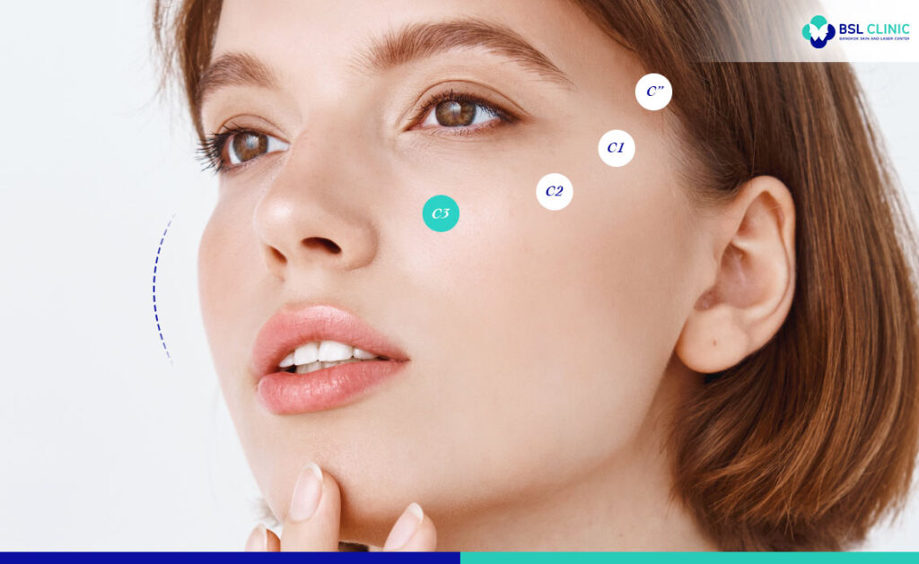 Cheek Volumization - The cheek is one part that makes a face look bright