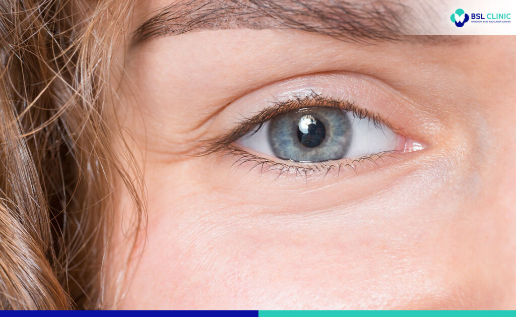 Periorbital Wrinkle Reduction – Support Smoother Eye Area