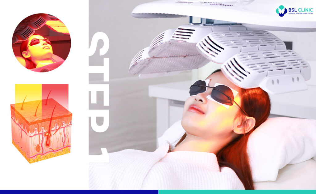 Effective Sensitive Skin & Seborrheic Dermatitis Treatments