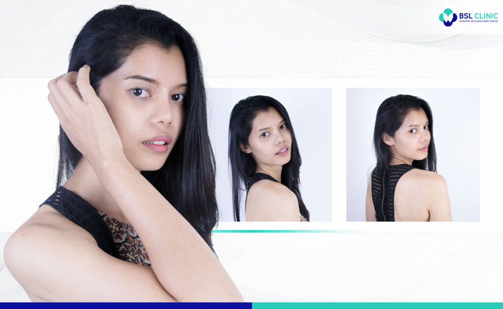 Effective Underarm Brightening and Smoothening Treatments