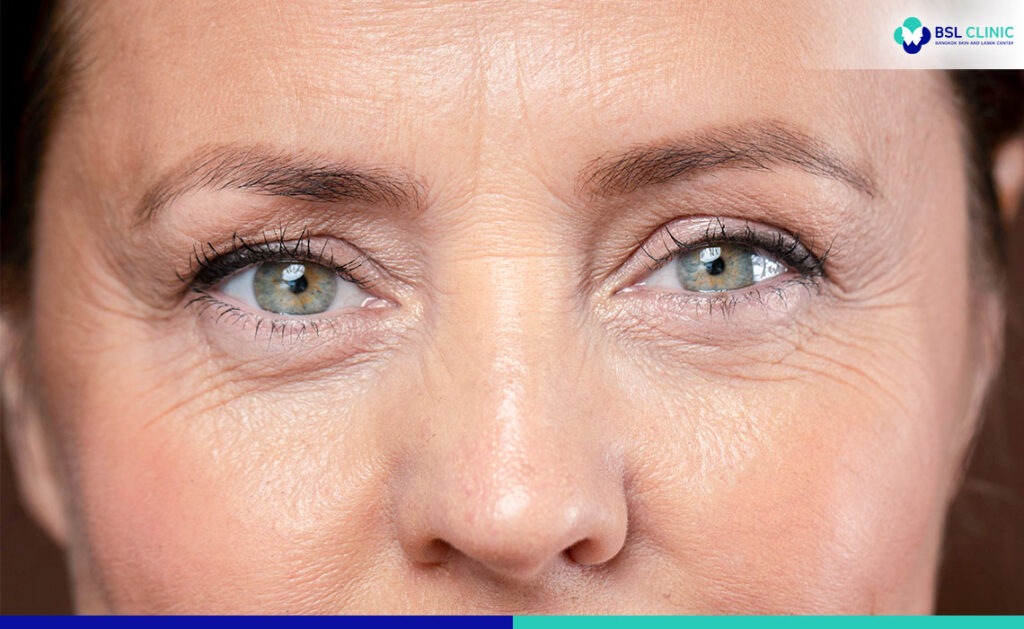 Face Wrinkle Reduction - Bangkok Aesthetic Clinic