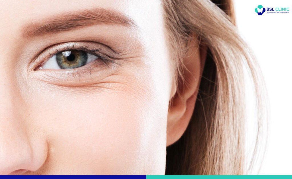 Eyes Wrinkle, Dark Circle, Eyes Bag, Droopy Eyelid - Bangkok Aesthetic ...