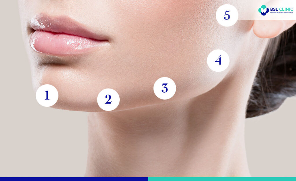 Customized & Effective Neck Wattle Treatments at BSL Clinic