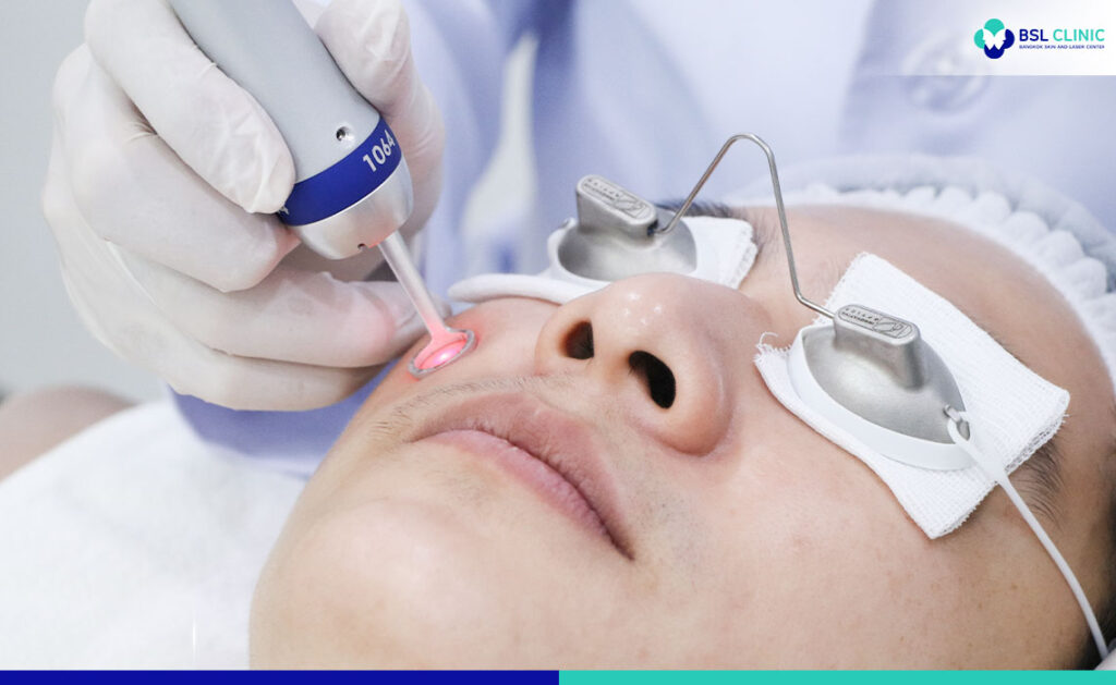 PicoWay Laser Program for Dark Spots, Wrinkles & Acne Scars