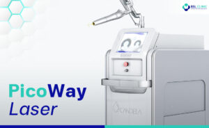 PicoWay Laser Program for Dark Spots, Wrinkles & Acne Scars