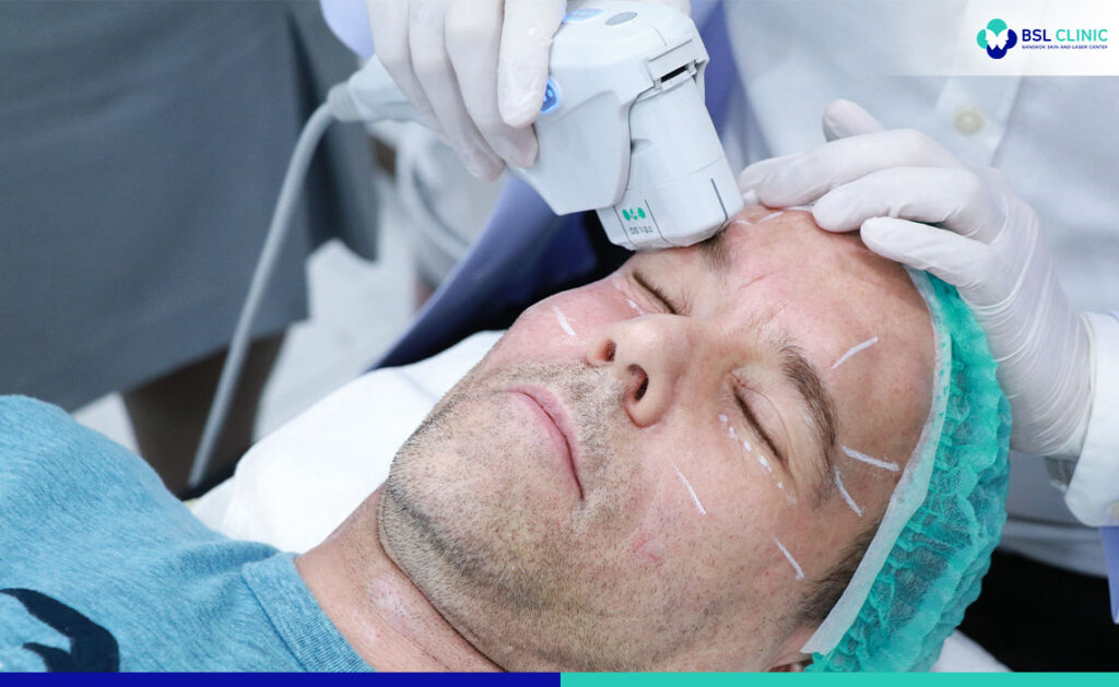 Enhance Your Look with Ultherapy Program: Non-Invasive Lift