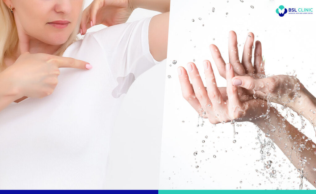 Hyperhidrosis Treatment: Effective Solutions for Sweating