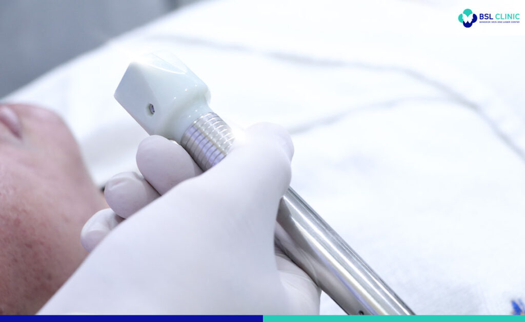 Fractora program: Treatment Supporting Skin Revitalization