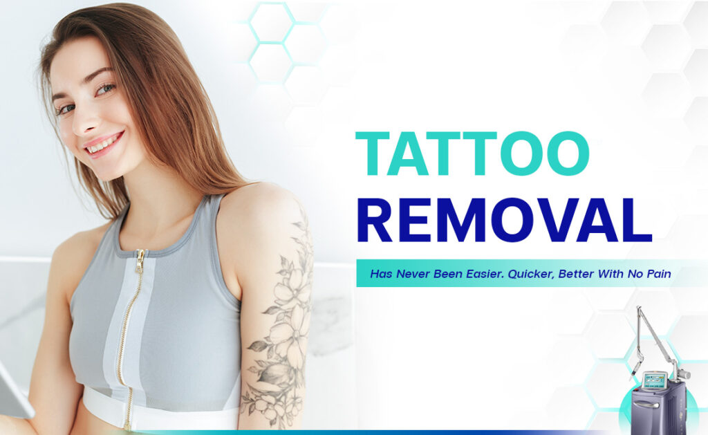 Revlite Laser Program Effective Laser Tattoo Removal