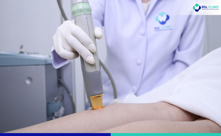 Vascular Laser Solutions for Vein & Skin Appearance