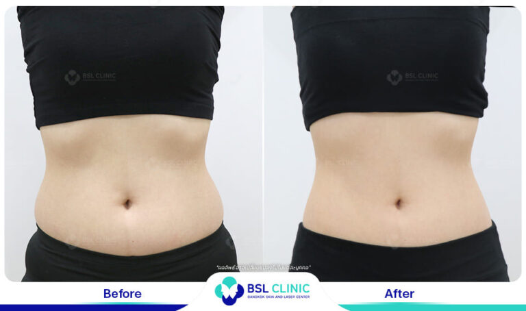 Real Results from Body Reshaping and Weight Loss Journey