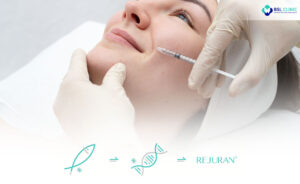 Rejuran Program: Collagen Booster and Revitalization