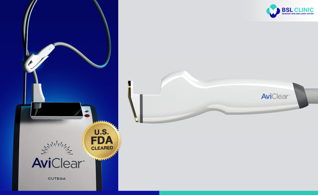 AviClear | Introduces You to the Future of Your Clear Skin.