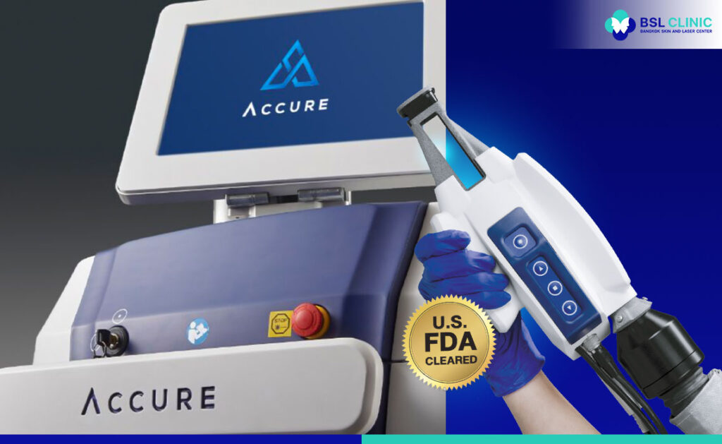 Accure Laser Treatment | Clear Solution for Acne