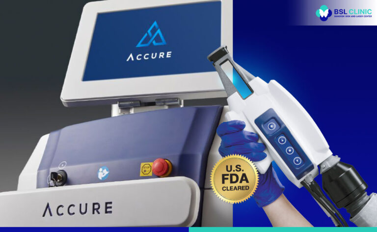 Accure Laser Treatment | Clear Solution for Acne