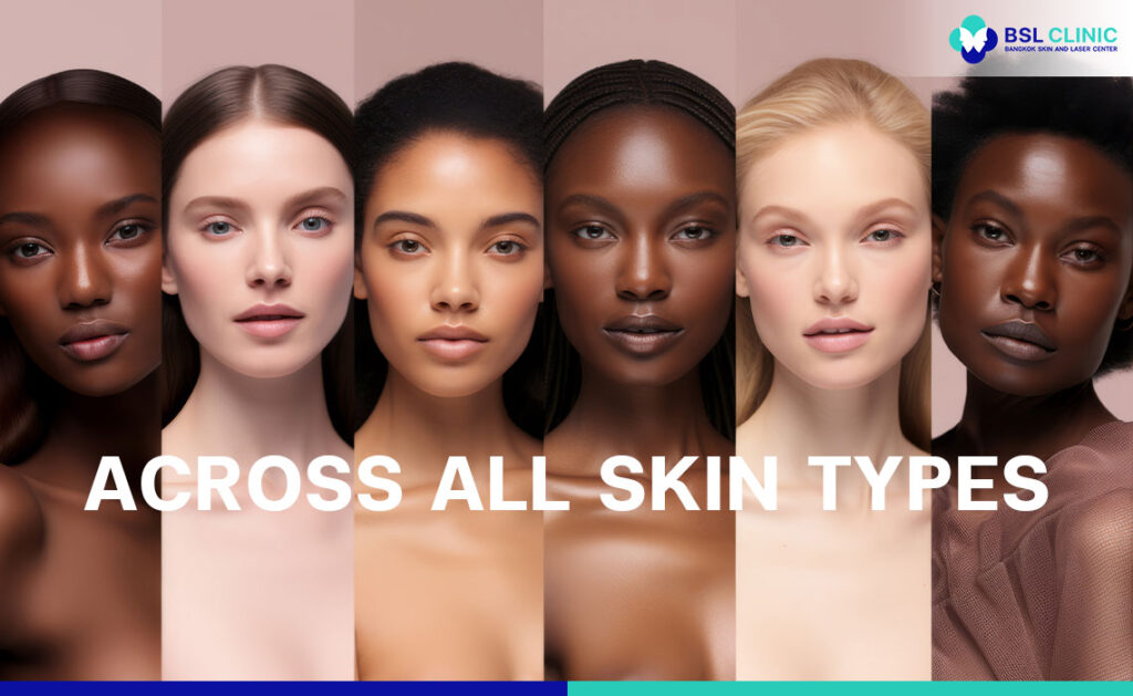 Accure Laser Treatment | Clear Solution for Acne