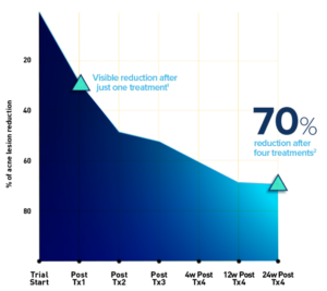 Accure Laser Program | An Effective Option for Acne Care