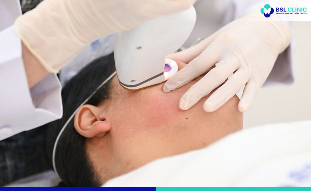 AviClear | Introduces You to the Future of Your Clear Skin.