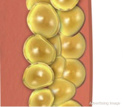 Insider CoolShaping2 Program: Vibrant Cryolipolysis Results