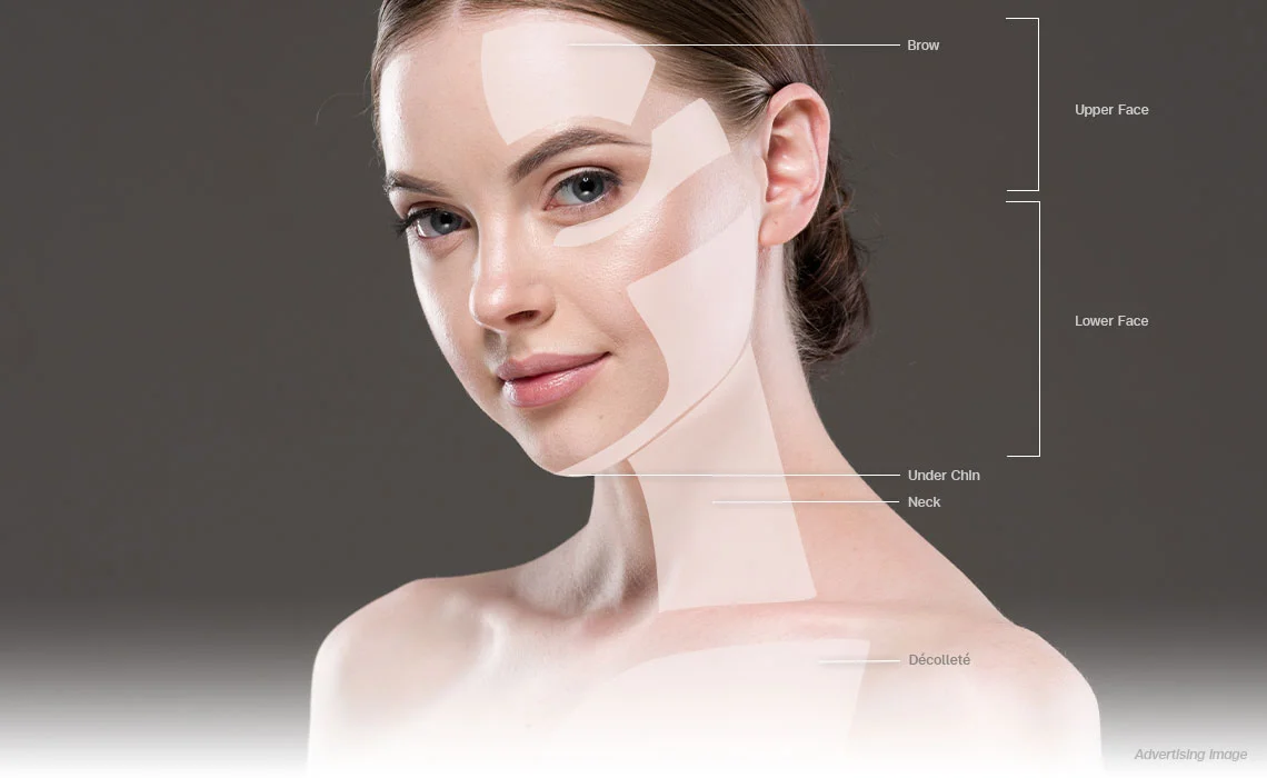 Ultherapy Prime Program – Subtle Lift, Remarkable You